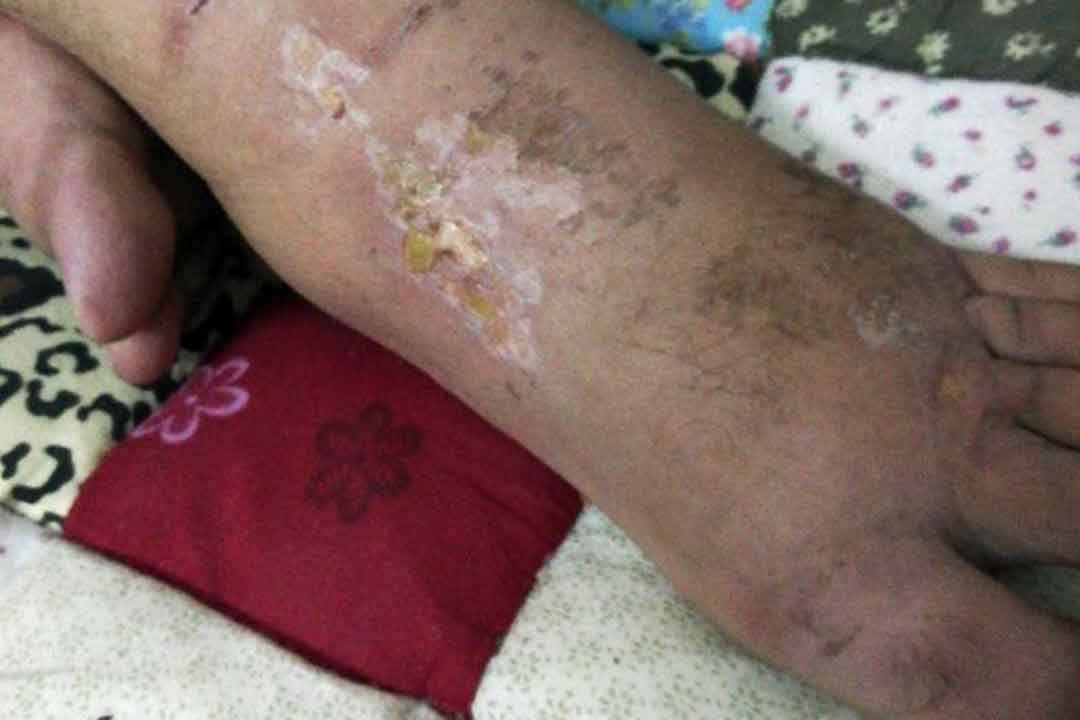 Testimoni pengguna ubat. Mudah guna, cepat sembuh • PS Herbs